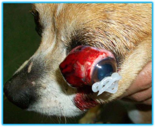 Proptose Ocular - CLOVE