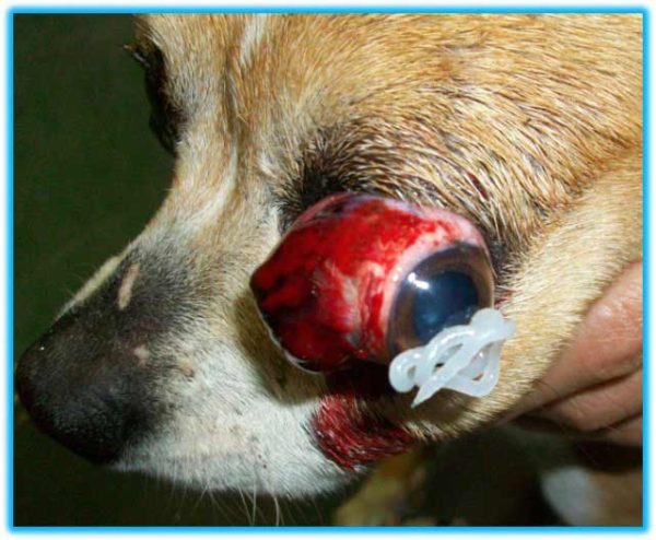 Proptose Ocular - CLOVE